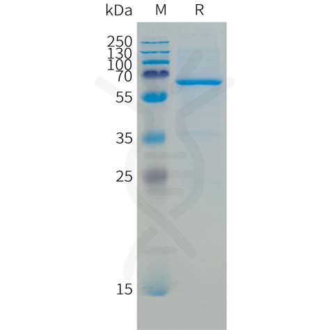 Human Cd73 Protein His Tag 专注肿瘤免疫