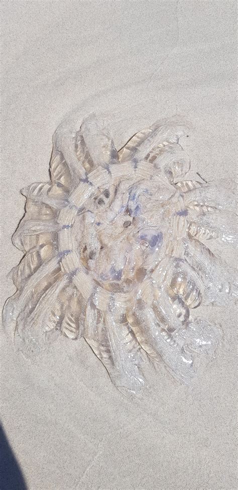 Jellyfish Sting At Altona Beach In Melbourne Australia I Believe It