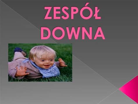 Zespół Downapptx Prezentacja Na Genetykę Ppt