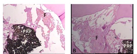 Light Microscopy Views Hande Staining X 40 Of Samples After Direct