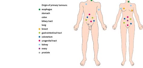 Major Localisations Of Cutaneous Metastases Of Frequent Visceral