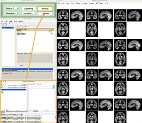 cat12 tutorial 3 preprocessing the data and qa checks — andy s brain