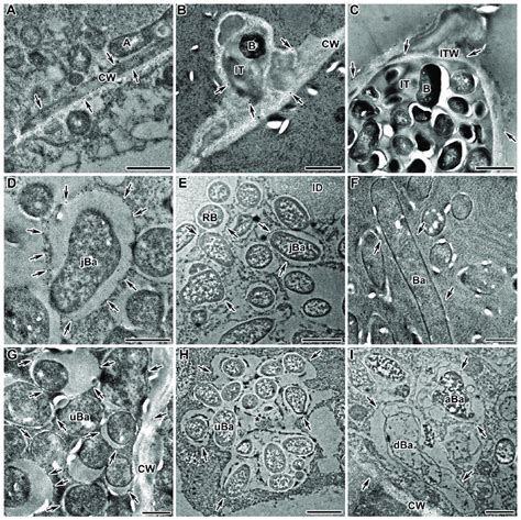 Immunogold Localisation Of The 1→5 α L Arabinan Side Chain Of
