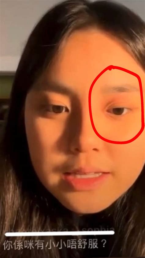 姚焯菲突開live預告即將回港 左眼驚現神秘紅腫令人擔心 最新娛聞 東方新地
