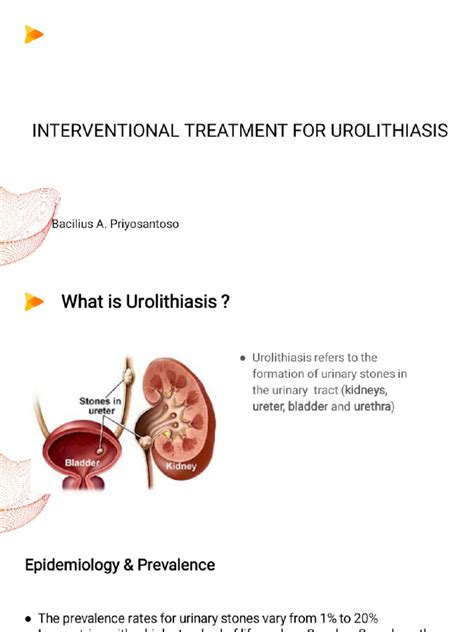 Interventional Treatment For Urolithiasis Dr Priyo Pdf
