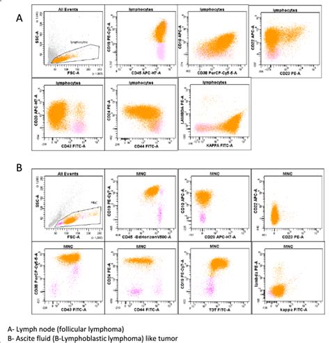 Flow Cytometric Analyses A First Lymph Node Follicular Lymphoma B