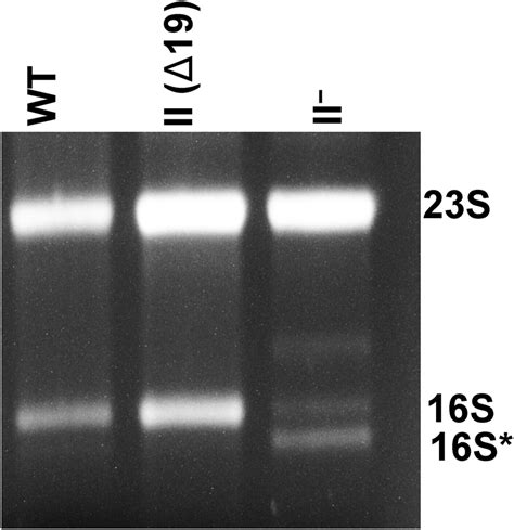 Effect Of Membrane Anchoring Domain Of Rnase Ii On Rrna Degradation