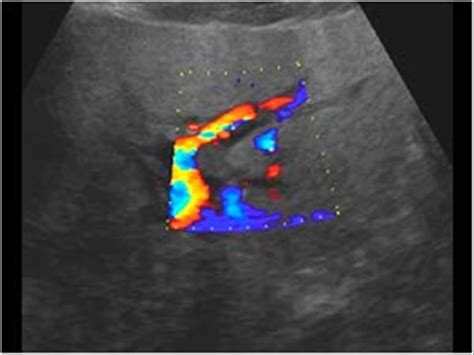Abdomen And Retroperitoneum 1 2 Gallbladder And Bile Ducts Case 1 2