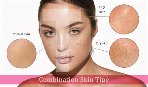 Cetaphil Vs Cerave Cleansers An In Depth Comparison For Best Skin
