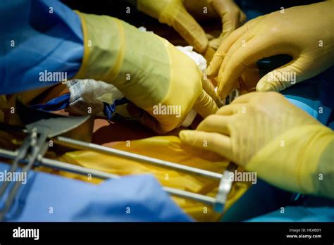 Laparotomy Hi Res Stock Photography And Images Alamy