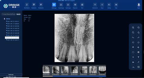 Dental Imaging Plate Scanner Phosphor Plate Scanner X Ray Scanner Buy