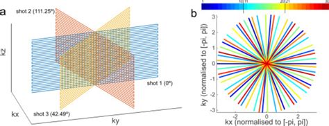 Diagram Of The 3d Hybrid Radial Cartesian Multishot Sampling Scheme Download Scientific Diagram