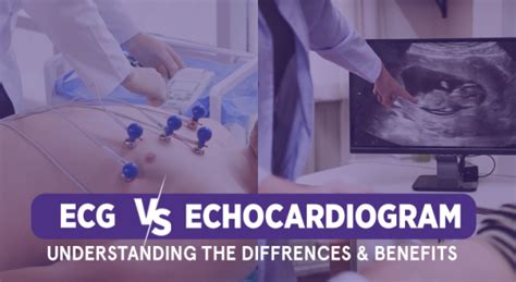 Ecg Vs Echocardiogram Understanding Differences Benefits