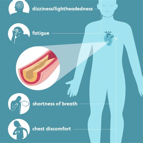 Coronary Artery Disease Powerpoint Template Ppt Slides Sketchbubble