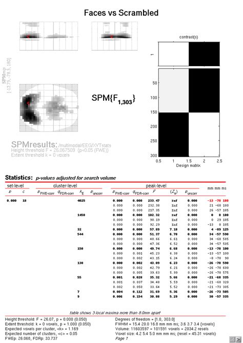 Eeg Spm Documentation