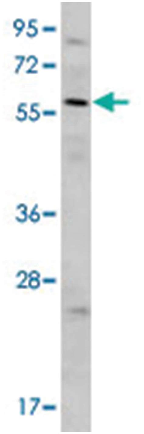 ANTI GPC ANTIBODY UL