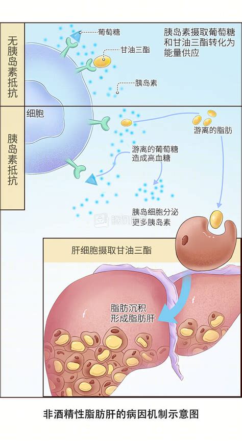 腾讯医典