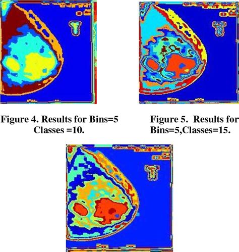Figure 1 From An Adaptive K Means Clustering Algorithm For Breast Image
