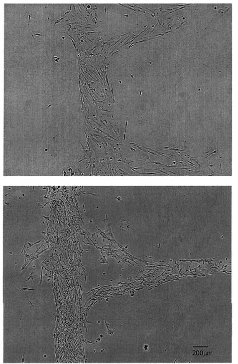 Light Micrograph Showing Huvec Migration From A Huvecccf Micropattern Download Scientific