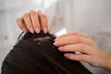 What To Use For Dry Scalp Effective Tips And Proven Products Nume
