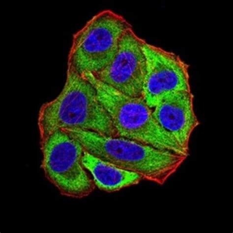 Pomc Mouse Anti Human Clone 6d2b5 Novus Biologicals 0 1 Ml