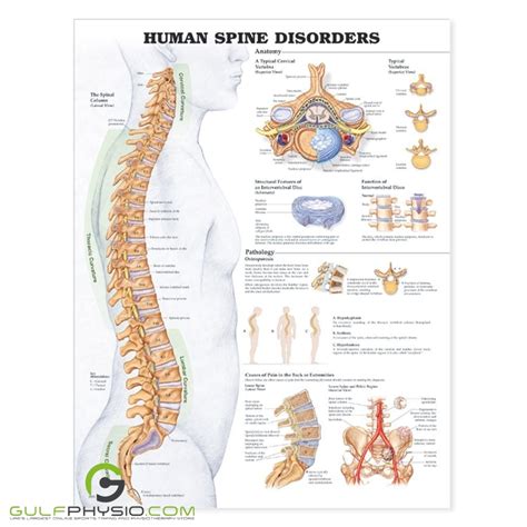 The Human Spine Disorders Chart Gulfphysio Uaes Online