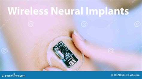 Wireless Neural Implants Implantable Electronic Medical Devices Concept