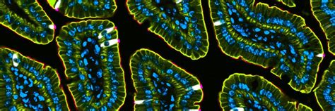 Immunofluorescence Imaging Tips STEMCELL Technologies