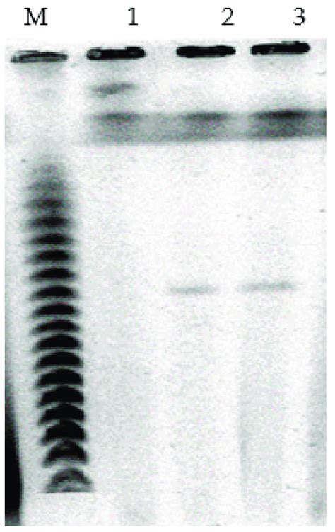 Electropherogram Of Plasmid Dna Of P Putida Strain Ch2 And P P
