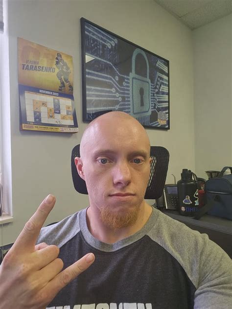 Can Someone Determine If Im Balding Or Thinning My Scalp Used To Be Less Visible Before Though