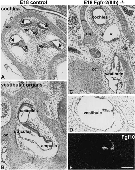 Targeted Deletion Of The Iiib Isoform Of Fgfr 2 Results In Dysgenesis