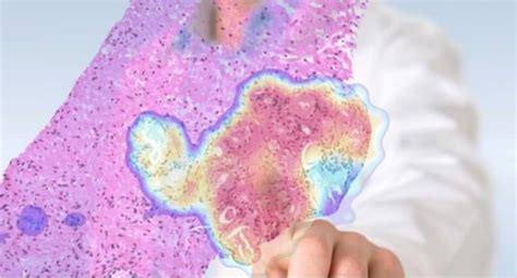 Towards Secure And Intelligent Diagnosis Deep Learning And Blockchain