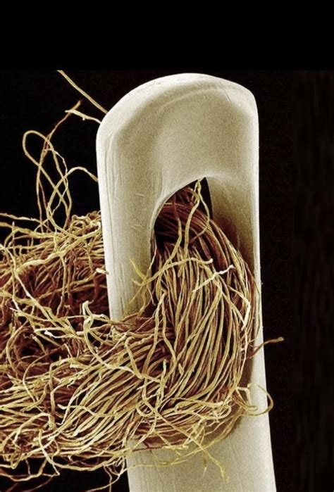 A Needle And Thread Under An Electron Microscope Rbeamazed