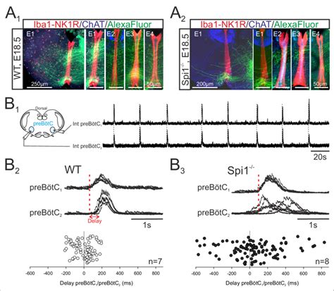 The bilateral preBötzinger complex preBötC networks exhibit abnormal