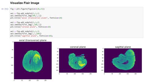 Github Ierolsen Brain Tumor Segmentation Brats 2019 This Repo Contains Brain Tumor