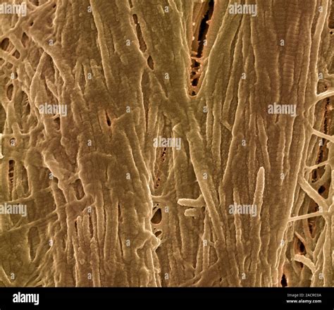 False Coloured Scanning Electron Micrograph Of Cortical Bone Compact Bone Cortical Bone Forms