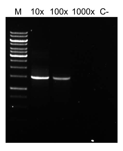 Video S RRNA Sequencing Identifying Bacterial Species By PCR