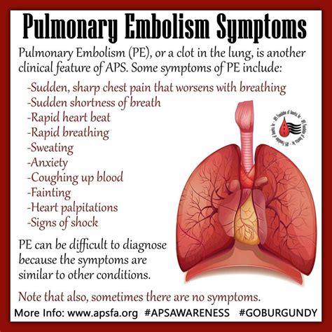 Signs And Symptoms Of Pulmonary Embolism Pe Pulmonary Grepmed My Xxx