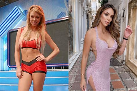 El Radical Cambio De Sheyla Rojas Cirugías En Todo El Cuerpo Y Exceso De Retoques En El Rostro