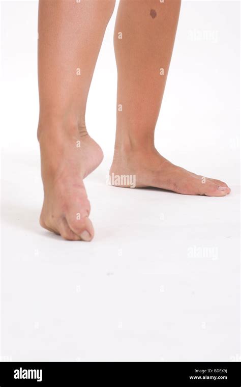 Are Ballerinas Feet Deformed At Elmer Pritchard Blog