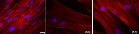 Embryonic Gene Nanog Reverses Aging In Adult Stem Cells Lab Manager