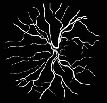 Image How To Segment Blood Vessels Python Opencv Stack Overflow