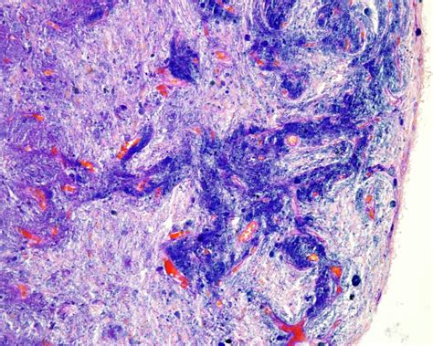 Posterior Pituitary Gland Photograph By Jose Calvo Science Photo