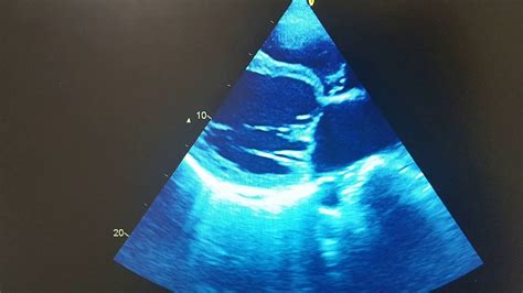 Echocardiography YouTube