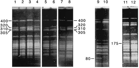 Mapping Cdc Linked Tn5 Insertions By Pfge The Drai Digestion Patterns
