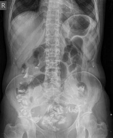 Abbreviations Ct Computed Tomography Git Gastrointestinal Tract Download Scientific Diagram