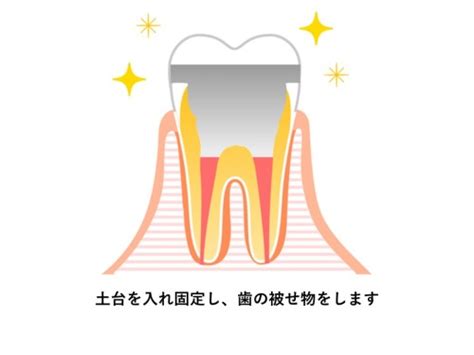 根管治療とは治療の流れと根管治療の重要性渋谷の歯医者渋谷マロン歯科Tokyo