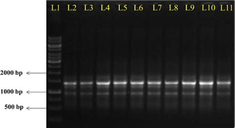 Start Codon Targeted Scot Profiles And Banding Pattern Of The Mother Download Scientific
