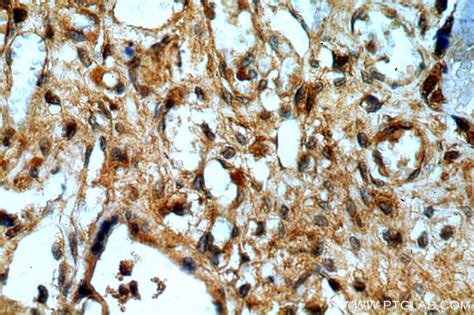 Peg10 Antibody 14412 1 Ap Proteintech