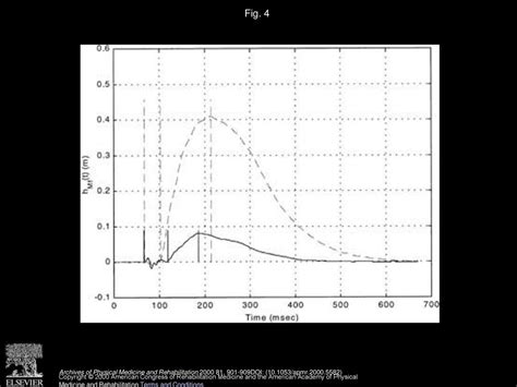 Hyperactive Tendon Reflexes In Spastic Multiple Sclerosis Measures And